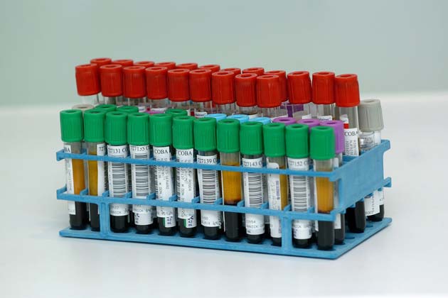 Qu'est-ce que la drépanocytose Qu'est-ce que la drépanocytose