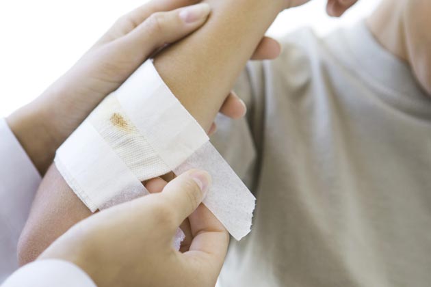 Stopper l'hémorragie