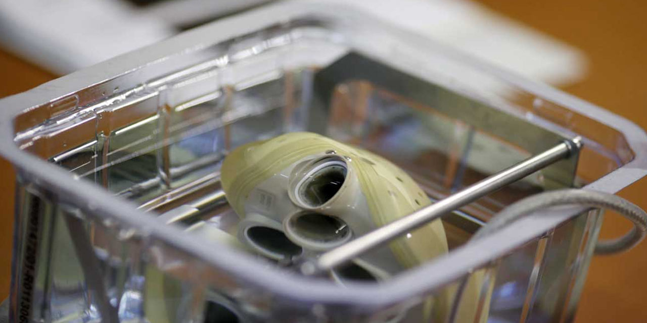 Le cœur artificiel a-t-il toujours un avenir