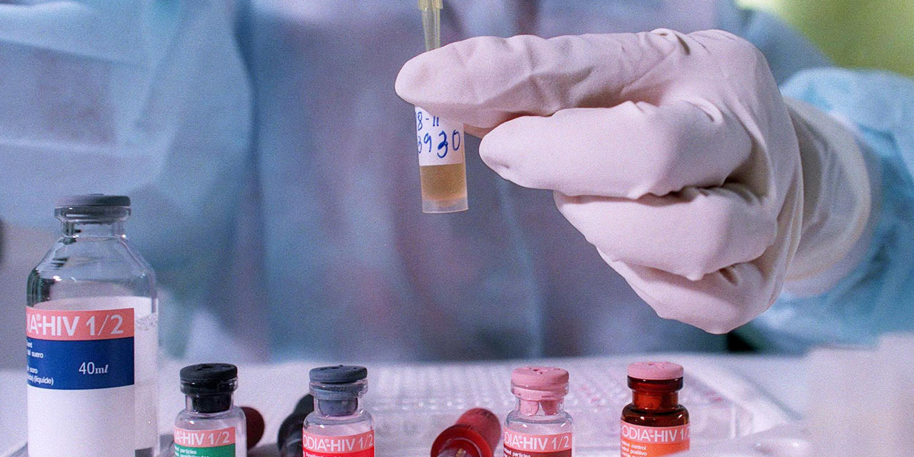 Sida : une substance anti-VIH durable testée avec succès sur des singes