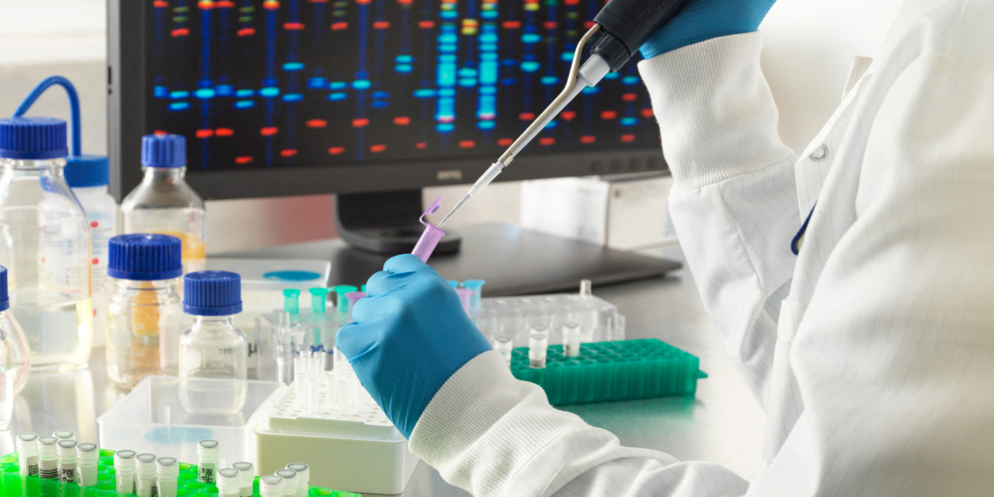 Va-t-on avoir un vaccin contre le cancer du pancréas ? Un vrai espoir ...