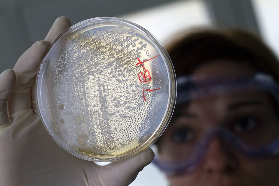 France : la souche bactérienne identifiée