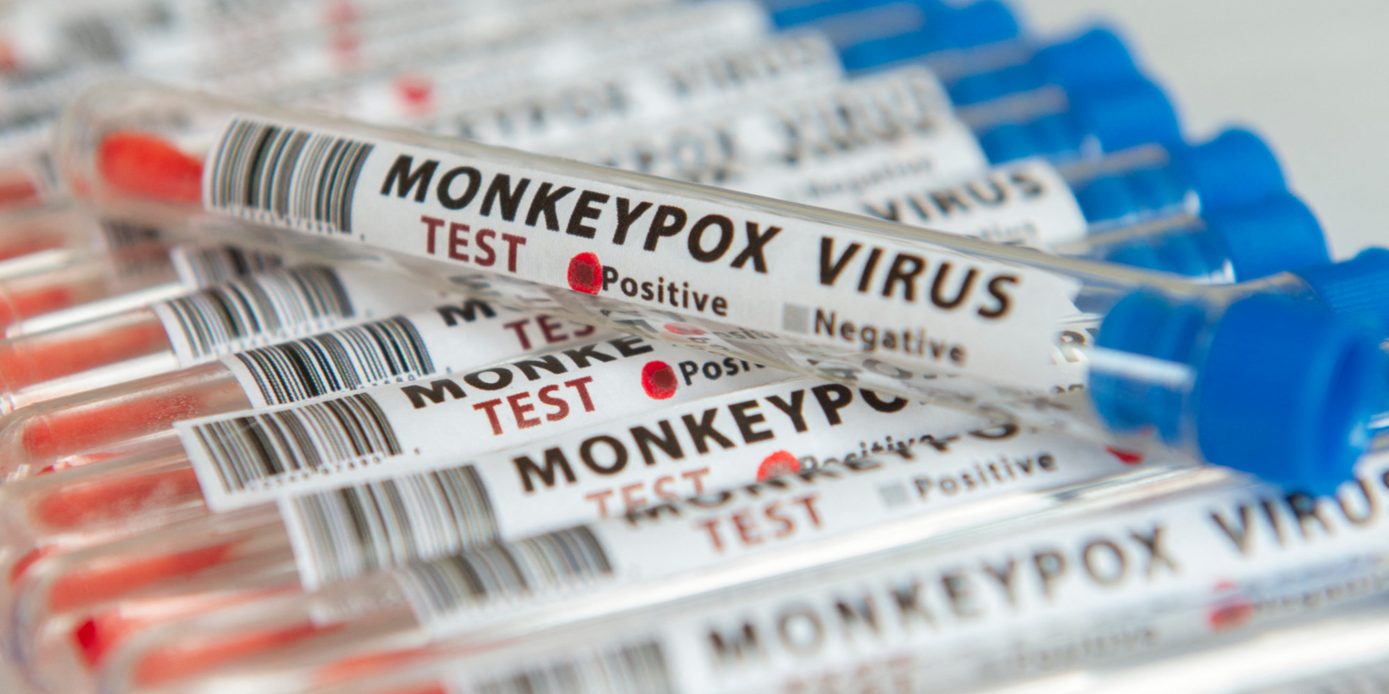 Variole du singe : l'hôpital de Nancy ouvre un centre de vaccination